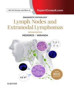 Diagnostic Pathology: Lymph Nodes and Extranodal: 3rd edition | L ...