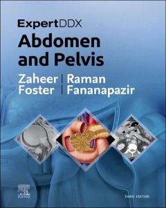 Imaging Anatomy: Chest, Abdomen, Pelvis: 3rd edition | Siva P. Raman ...