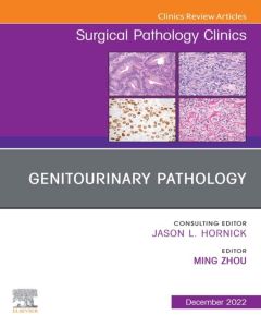 Uropathology: 2nd edition | Ming Zhou | ISBN: 9780323653954 | Elsevier ...