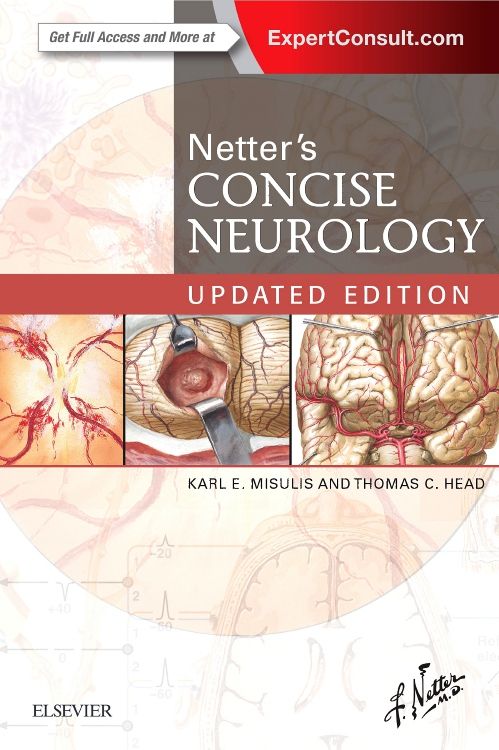 Netter's Concise Neurology Updated Edition: 1st edition | Karl E ...