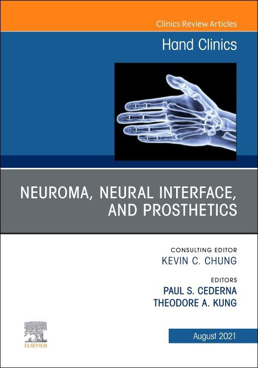 Neuroma, Neural Interface, and Prosthetics, An I: 1st edition | Edited ...