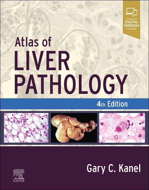 Atlas of Liver Pathology: 4th edition | Gary C. Kanel | ISBN ...