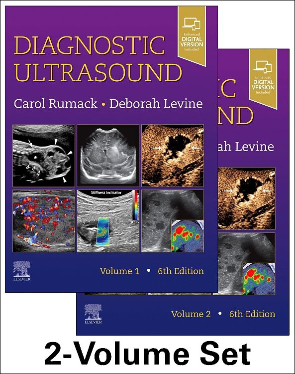 Diagnostic Ultrasound, 2-Volume Set: 6th edition | Edited by Carol M. Rumack | ISBN ...