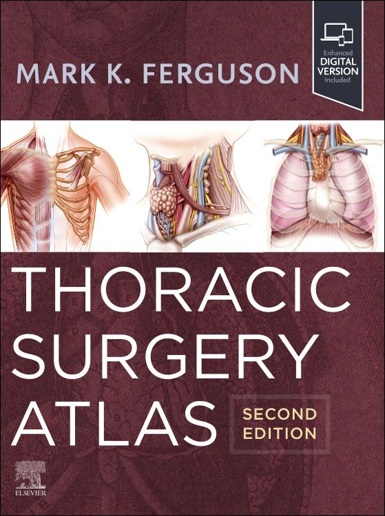 Thoracic Surgery Atlas: 2nd edition | Mark K. Ferguson | ISBN ...