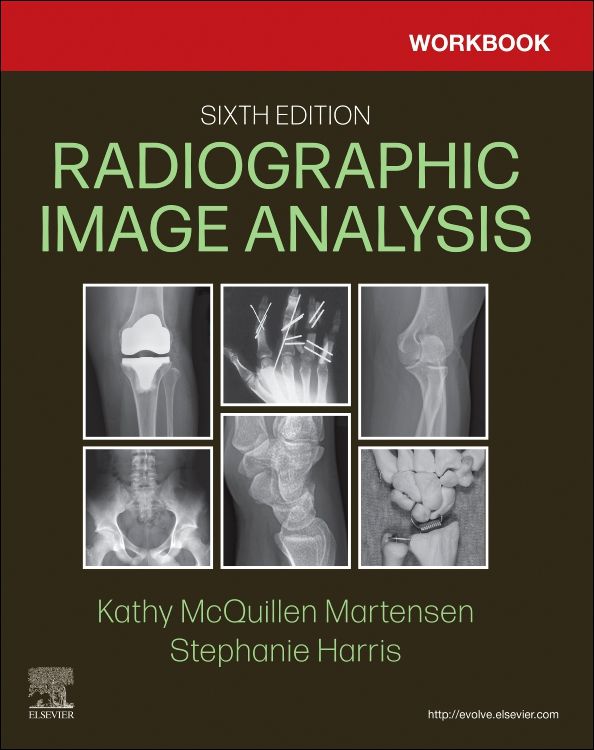 Workbook for Radiographic Image Analysis: 6th edition | Kathy McQuillen ...