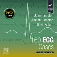 160 ECG Cases: 6th edition | John Hampton | ISBN: 9780323937658 ...