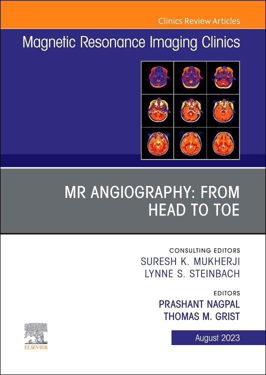MR Angiography: From Head to Toe, An Issue of Ma: 1st edition | Edited ...