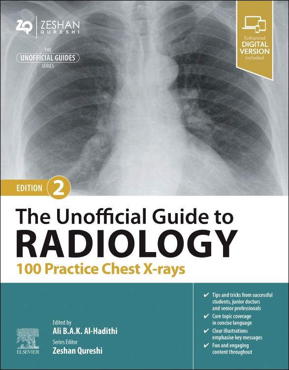 The Unofficial Guide to Radiology: 100 Practice: 2nd edition | Edited ...