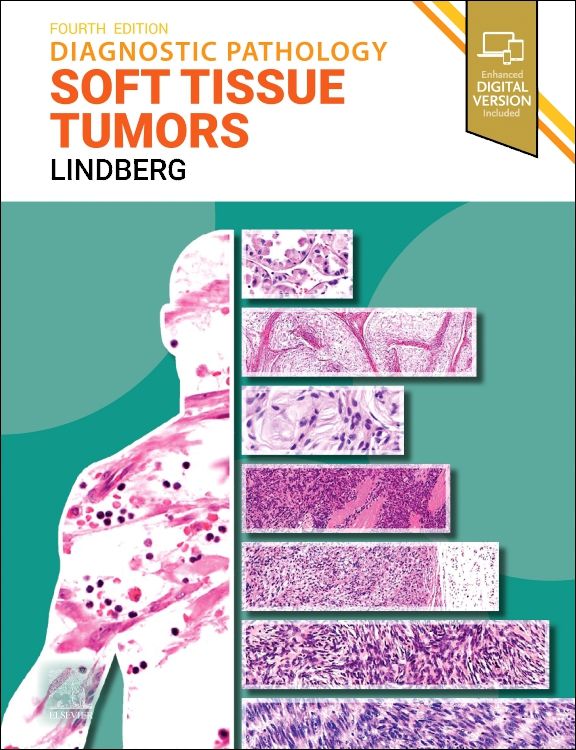Diagnostic Pathology: Soft Tissue Tumors: 4th edition | Matthew R. Lindberg | ISBN ...