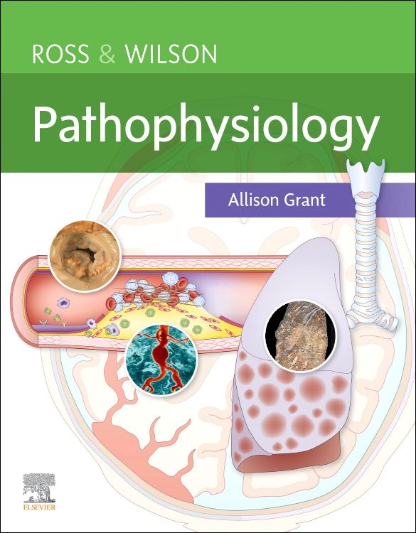 Ross & Wilson Pathophysiology: 1st edition | Allison Grant | ISBN ...