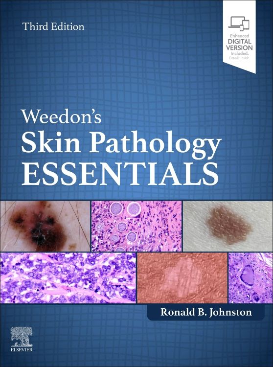 Weedon's Skin Pathology Essentials: 3rd edition | Ronald Johnston ...