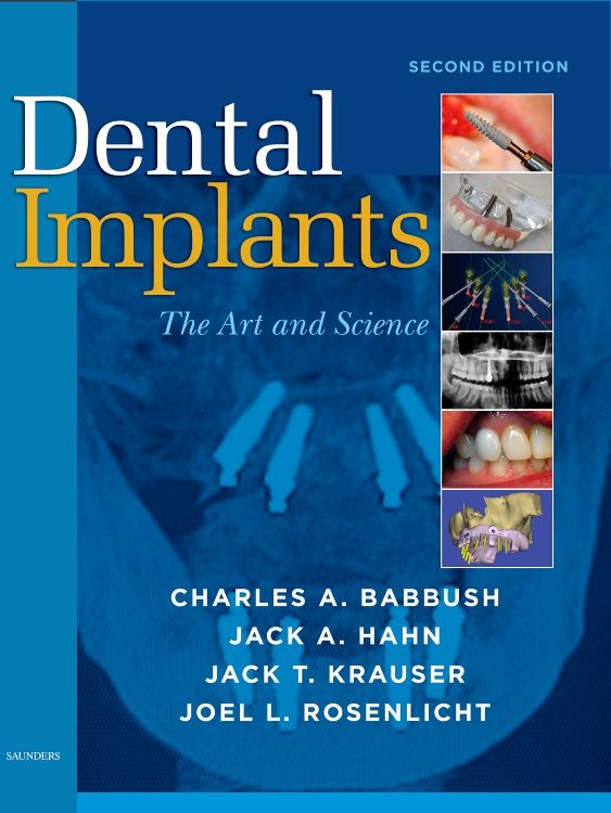 Dental Implants: 2nd edition | Charles A. Babbush | ISBN: 9781416053415 ...
