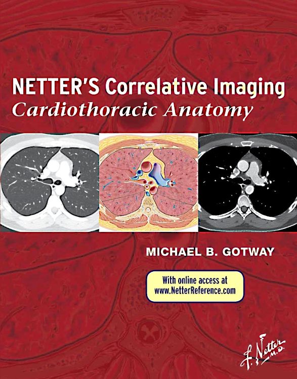 Netter’s Correlative Imaging: Cardiothoracic Ana: 1st edition | Michael ...